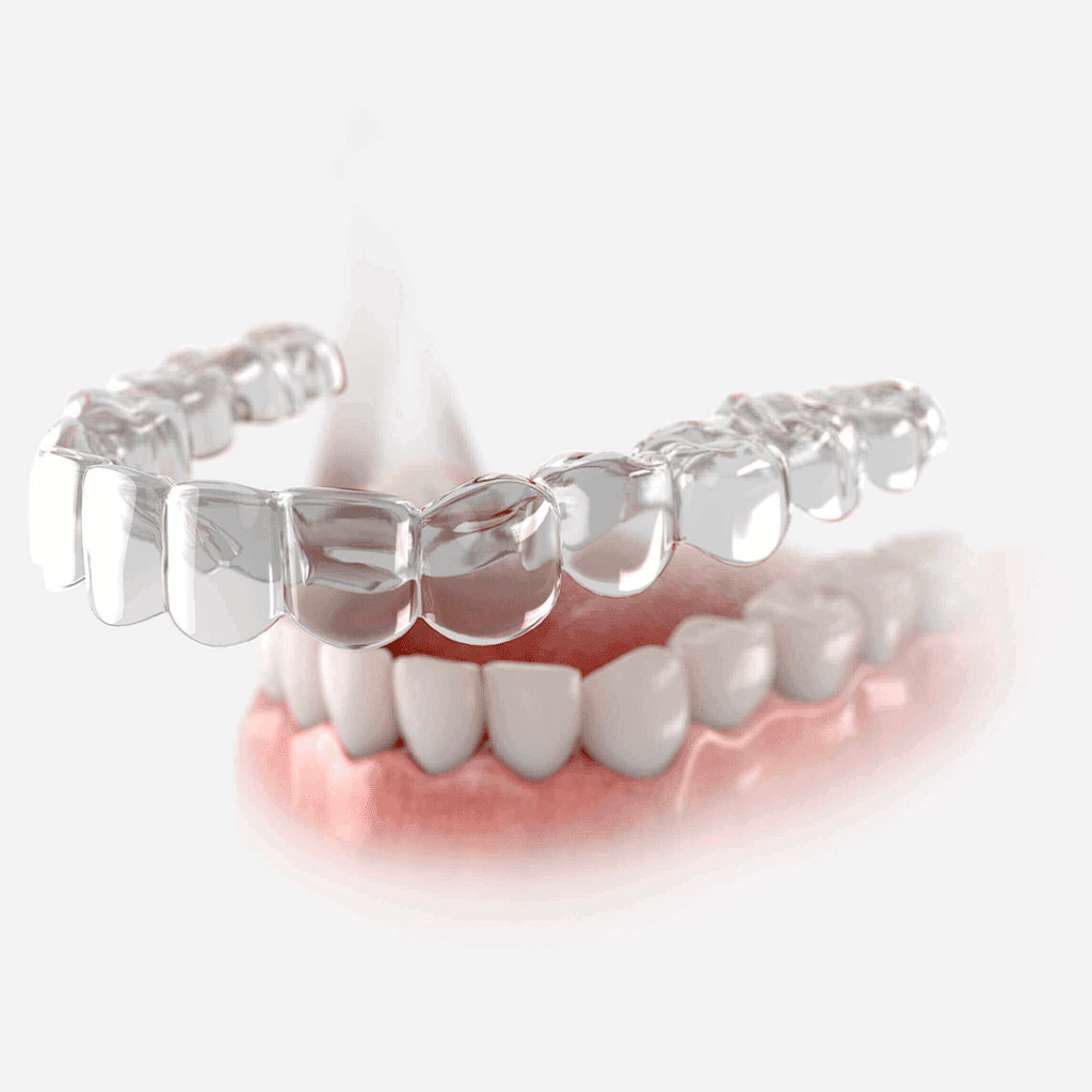 Invisalign 3 – Westcountry Open Day